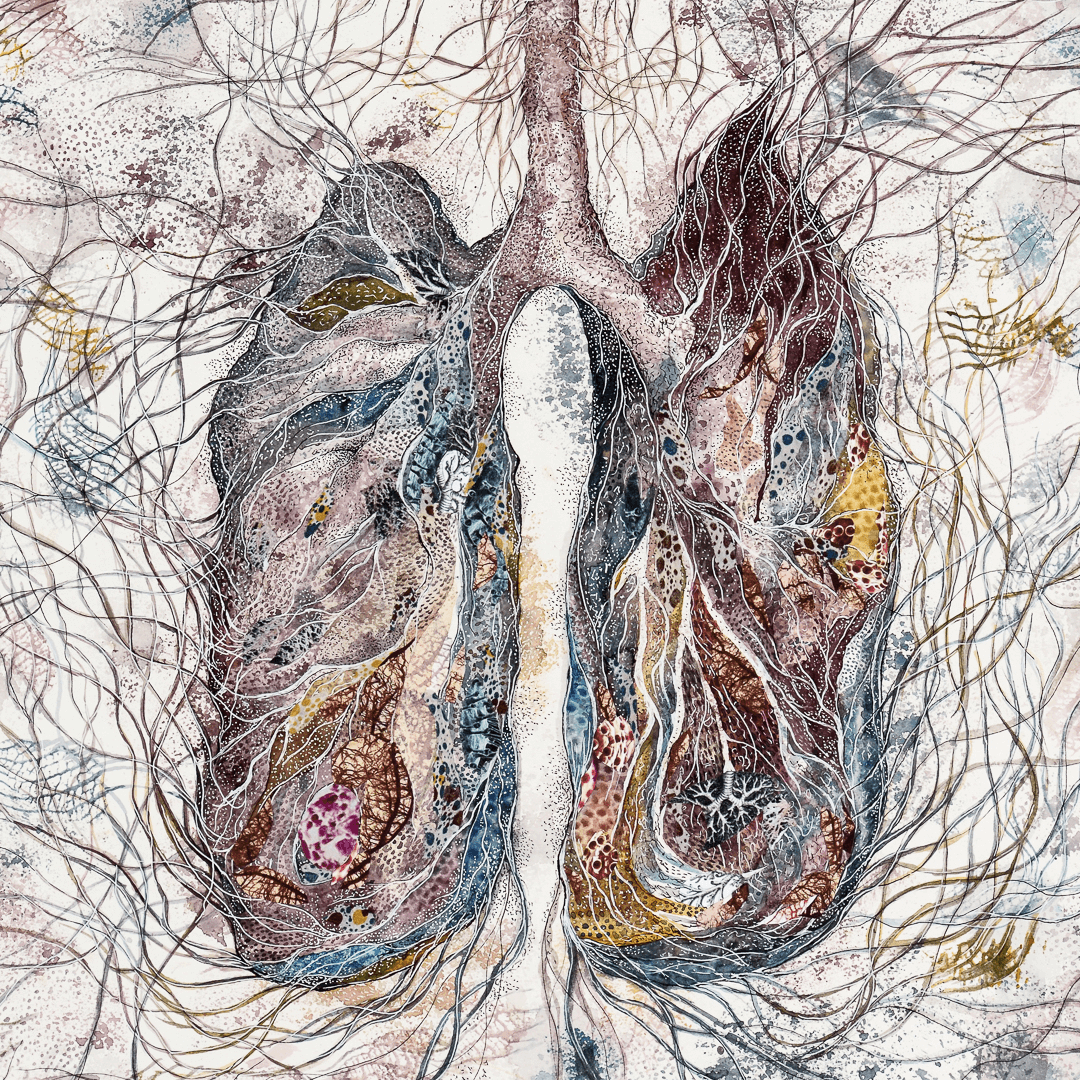 DEVIKA SUNDAR – KYNKYNY Art Gallery